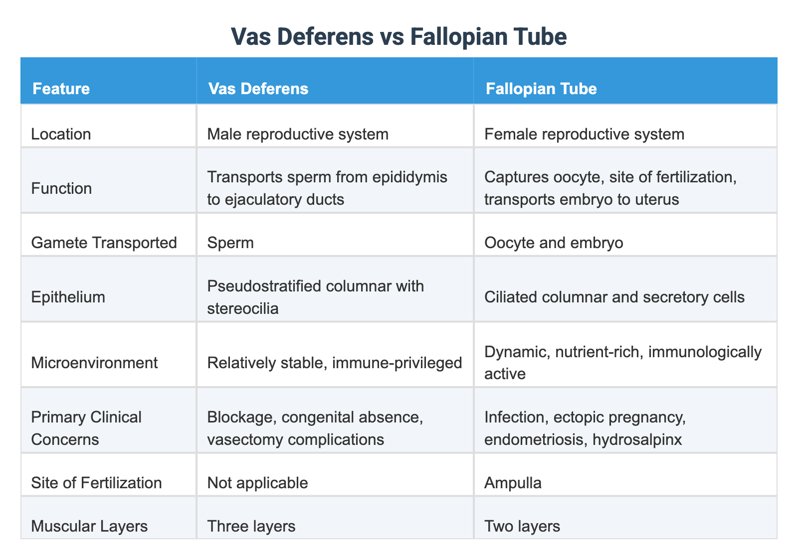 Vas Deferens vs Fallopian Tube